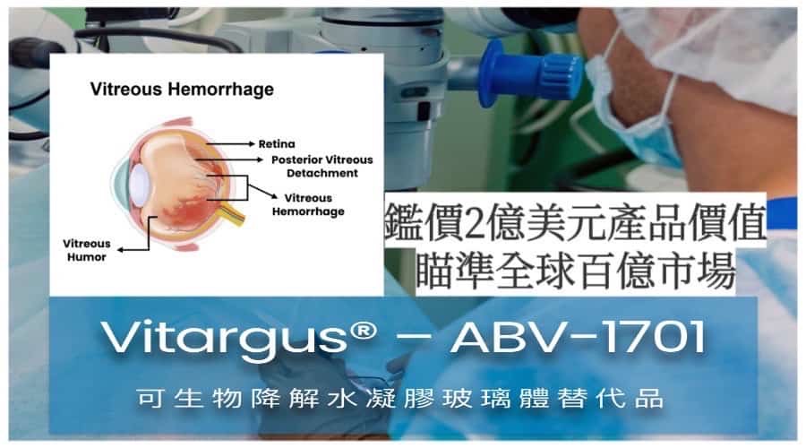 眼科醫材臨床穩定，鑑價2億美元可望獨立成長，ABVC集團體現母以子貴資本擴張優勢 - 全球財經專業評論 | 投資網誌 | 玩股網